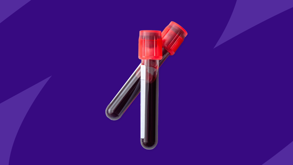 Hematocrit levels: What do your hematocrit test results mean?