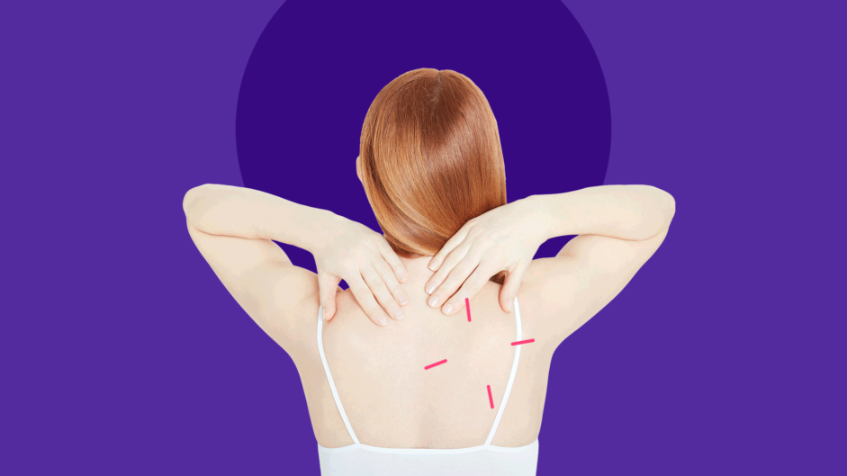 What is Xulane? Birth control patch benefits and side effects