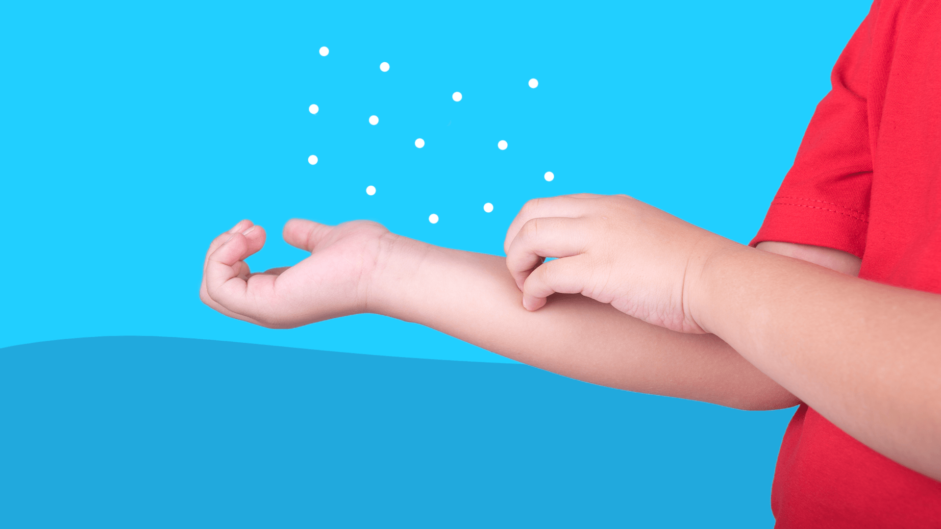 Ringworm in kids: The parent’s guide to symptoms and treatment