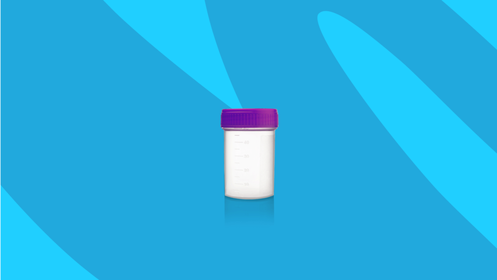 Urinalysis: What it is, purpose, and results