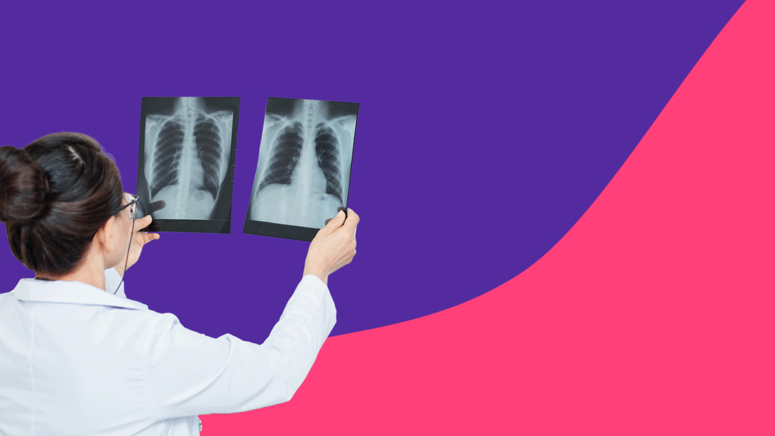 Common causes of pain under the left rib cage and when to worry