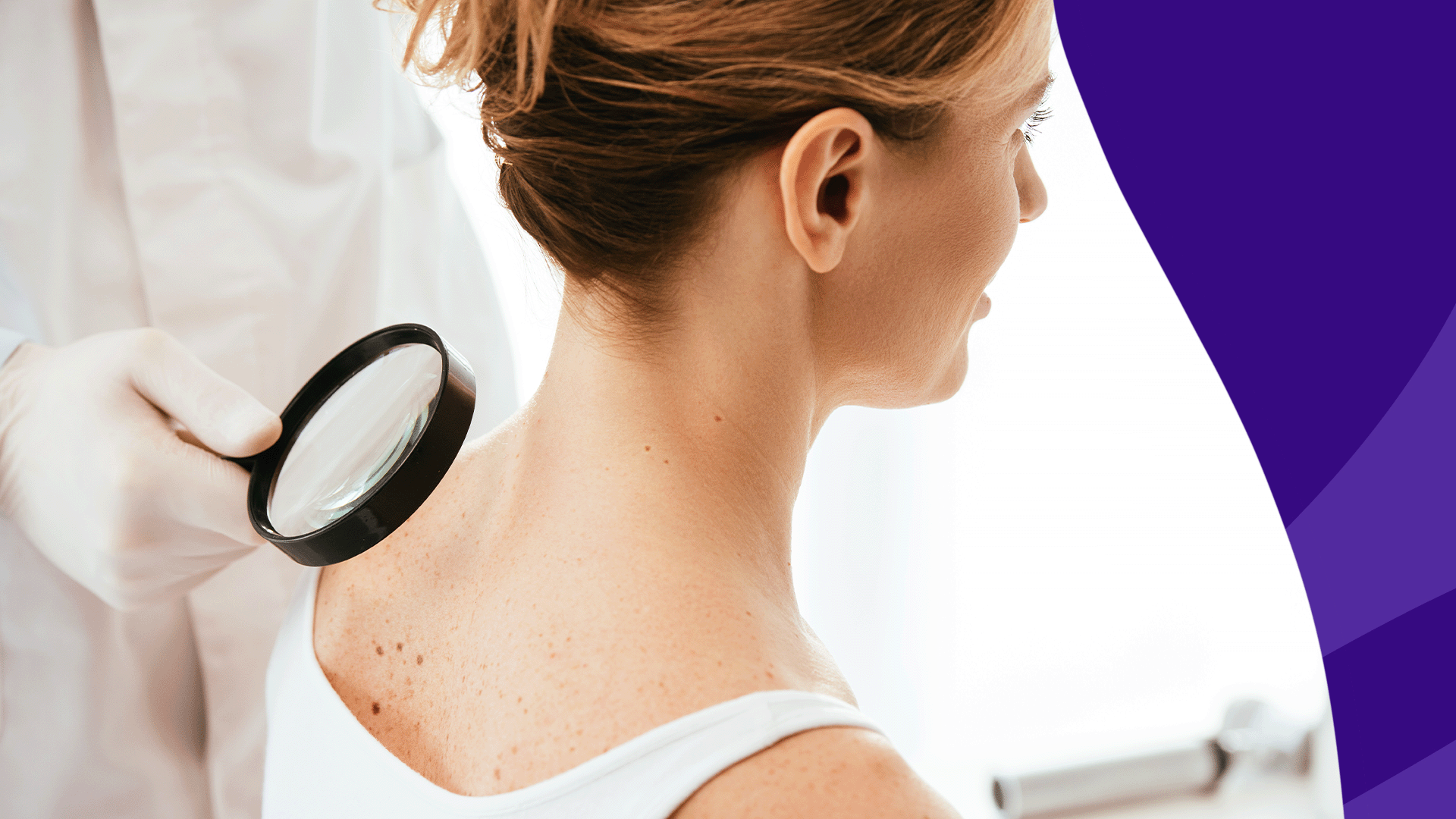 Understanding lamotrigine (Lamictal) Rash: Symptoms, causes, and treatment